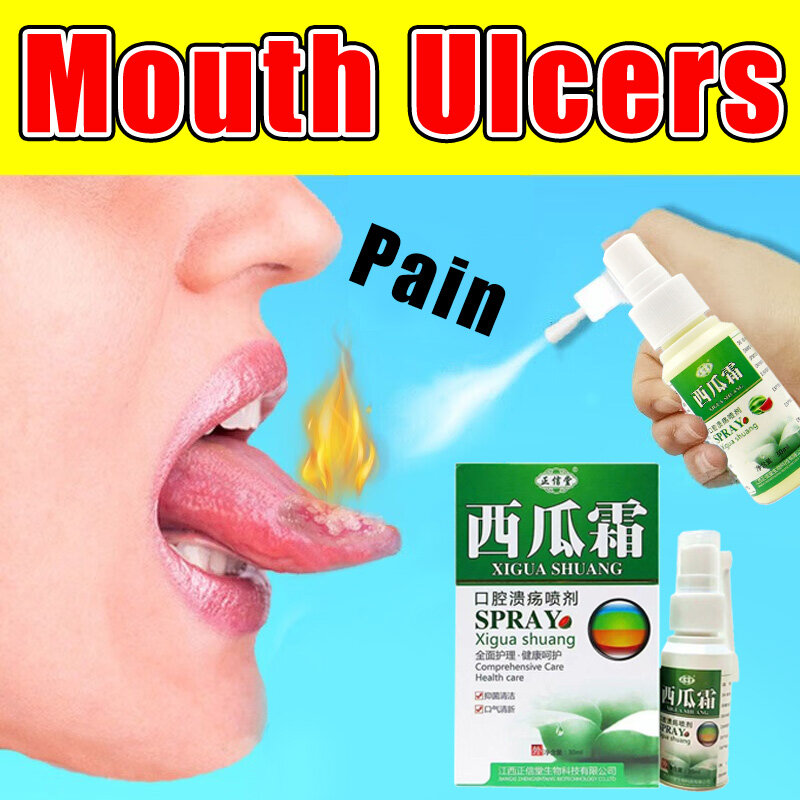 Shop Oral Ulser Patch online | Lazada.com.my